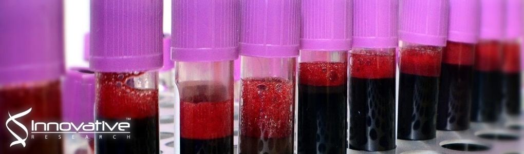Biofluid sampler: A new gateway for mail-in-analysis of whole blood sa ...