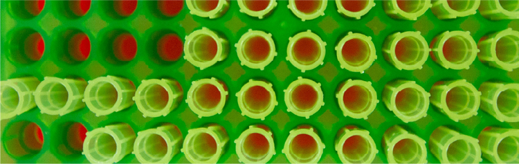 We Sell Factor XII ELISA Kits – Innovative Research