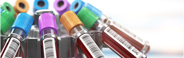 How to Properly Thaw Plasma – Innovative Research