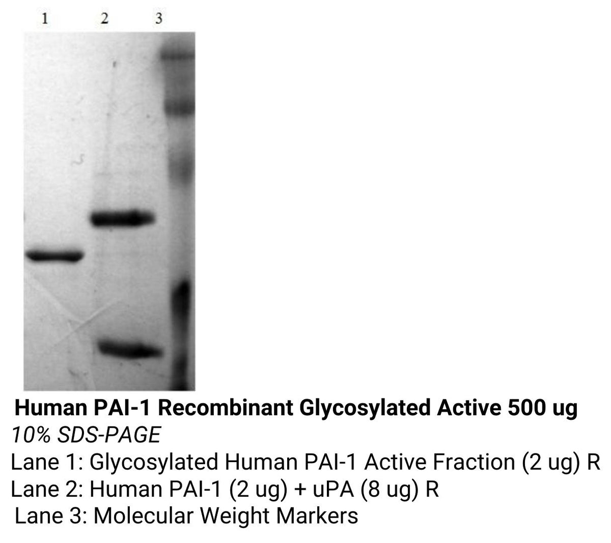 *Human Pai 1 Recombinant Glycosylated Active – Innovative Research