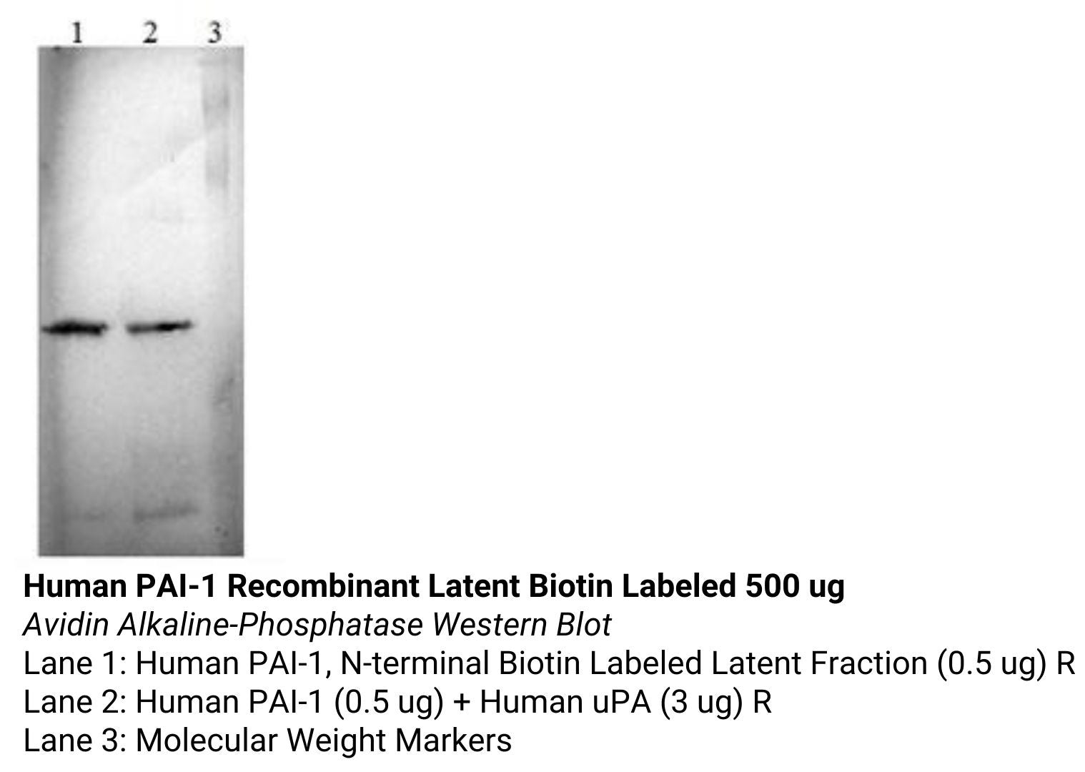 *Human Pai 1 Recombinant Latent Biotin Labeled – Innovative Research