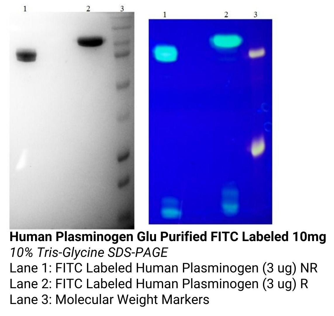 *Human Plasminogen Glu Purified FITC Labeled – Innovative Research