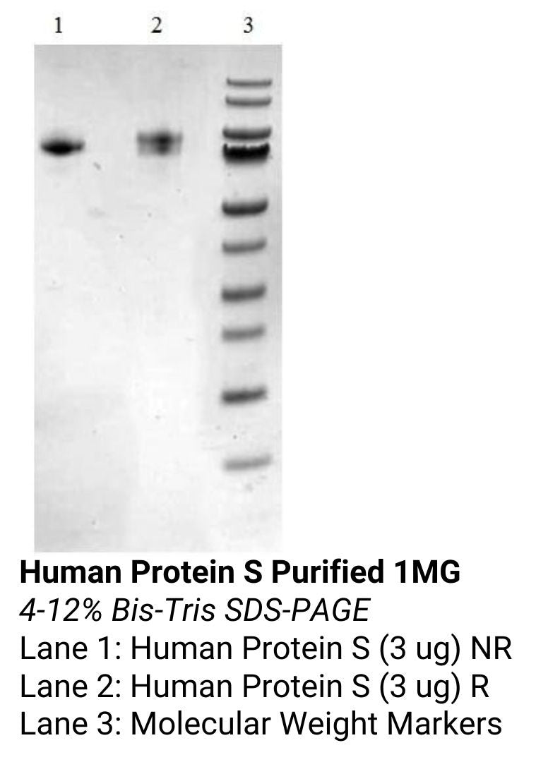 Human Protein S Purified – Innovative Research