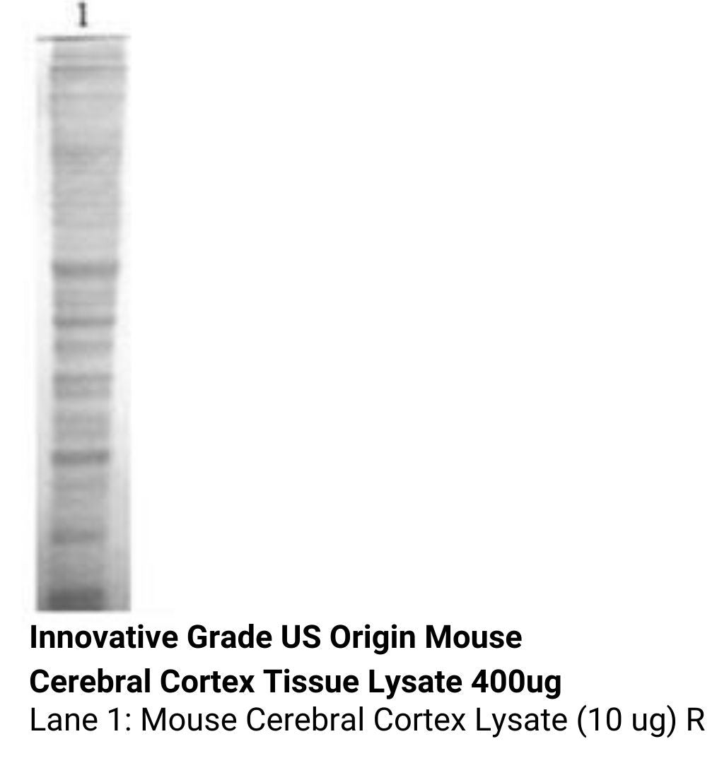 Cerebral Cortex Tissue