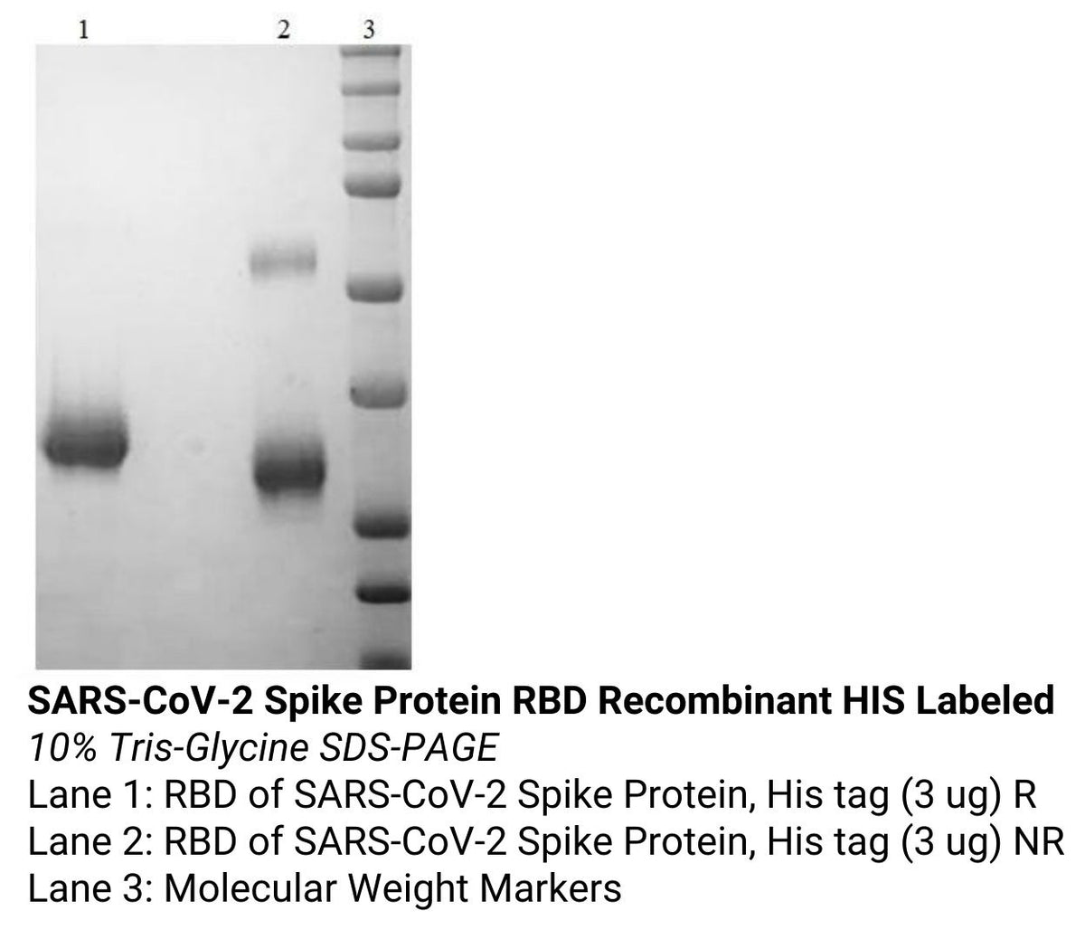 *SARS-CoV-2 Spike Protein RBD Recombinant HIS Labeled – Innovative Research